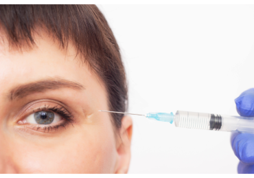 Steroid Injections for Raised Scars: How it Works?