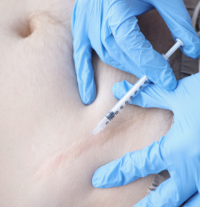 Steroid injections - London Keloid Scar Clinic