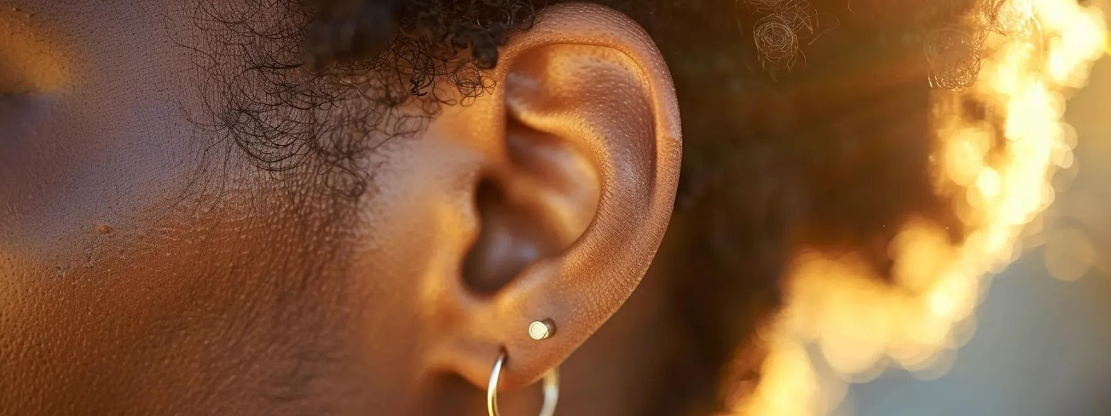 Keloid Ear Risk Factors Explained - London Keloid Scar Clinic